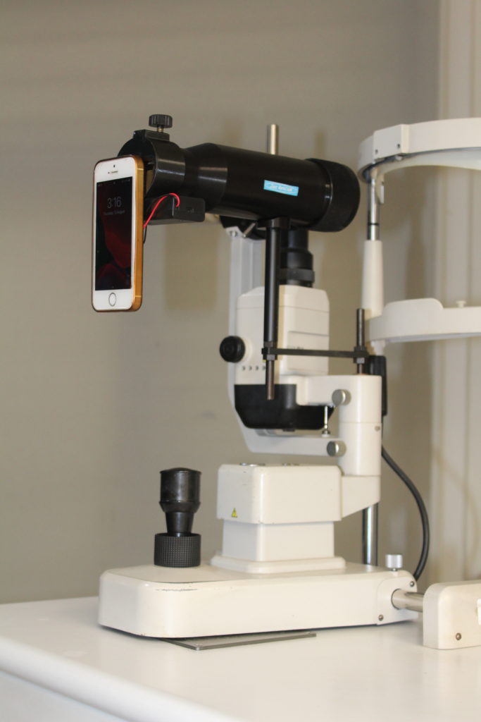 Smartphone based Fundus Retinal Camera Economical and best